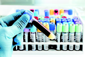 laboratory technician holding a blood tube test - Natural Awakenings ...